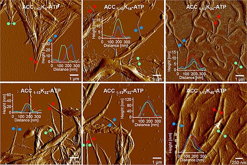 Understanding Protein Dysfunction: The Role of Liquid Droplets and ...